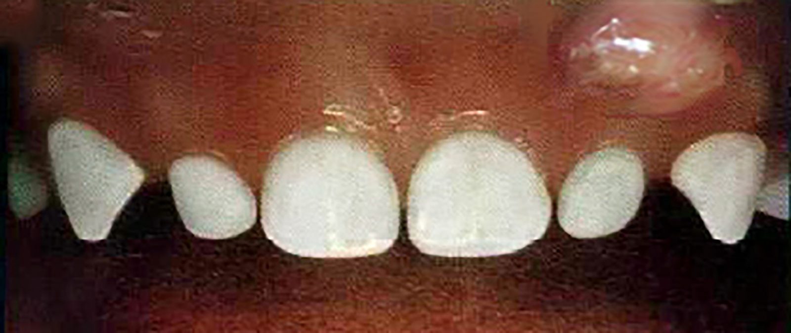 Healthy Parents Healthy Children